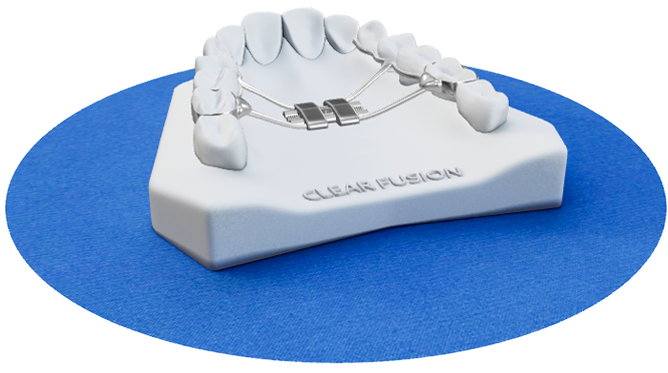3D RPE - Clear Fusion