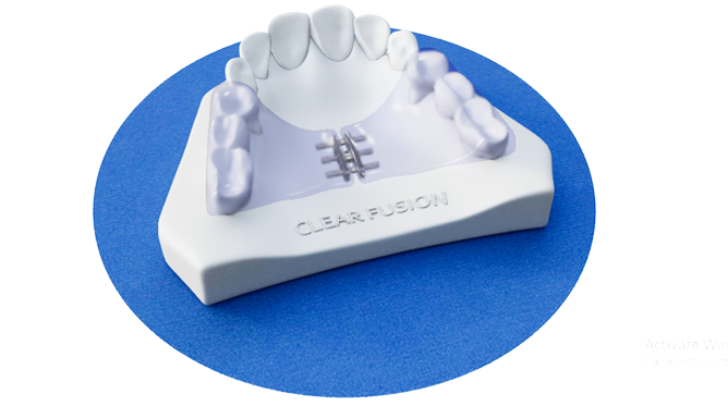 Bonded Acrylic RPE - Clear Fusion