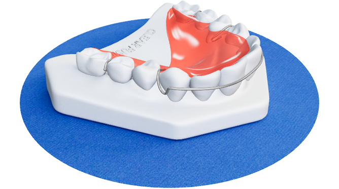 Maxillary Hawley with Ball Clasps - Clear Fusion