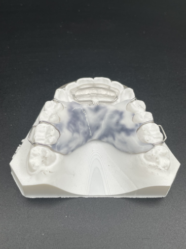 Maxillary Modified Spring Retainer Plus with Adams - Clear Fusion